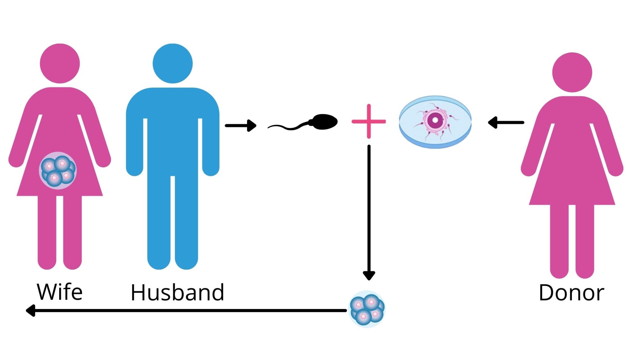 What is egg donation and its process? @globalivfclinic